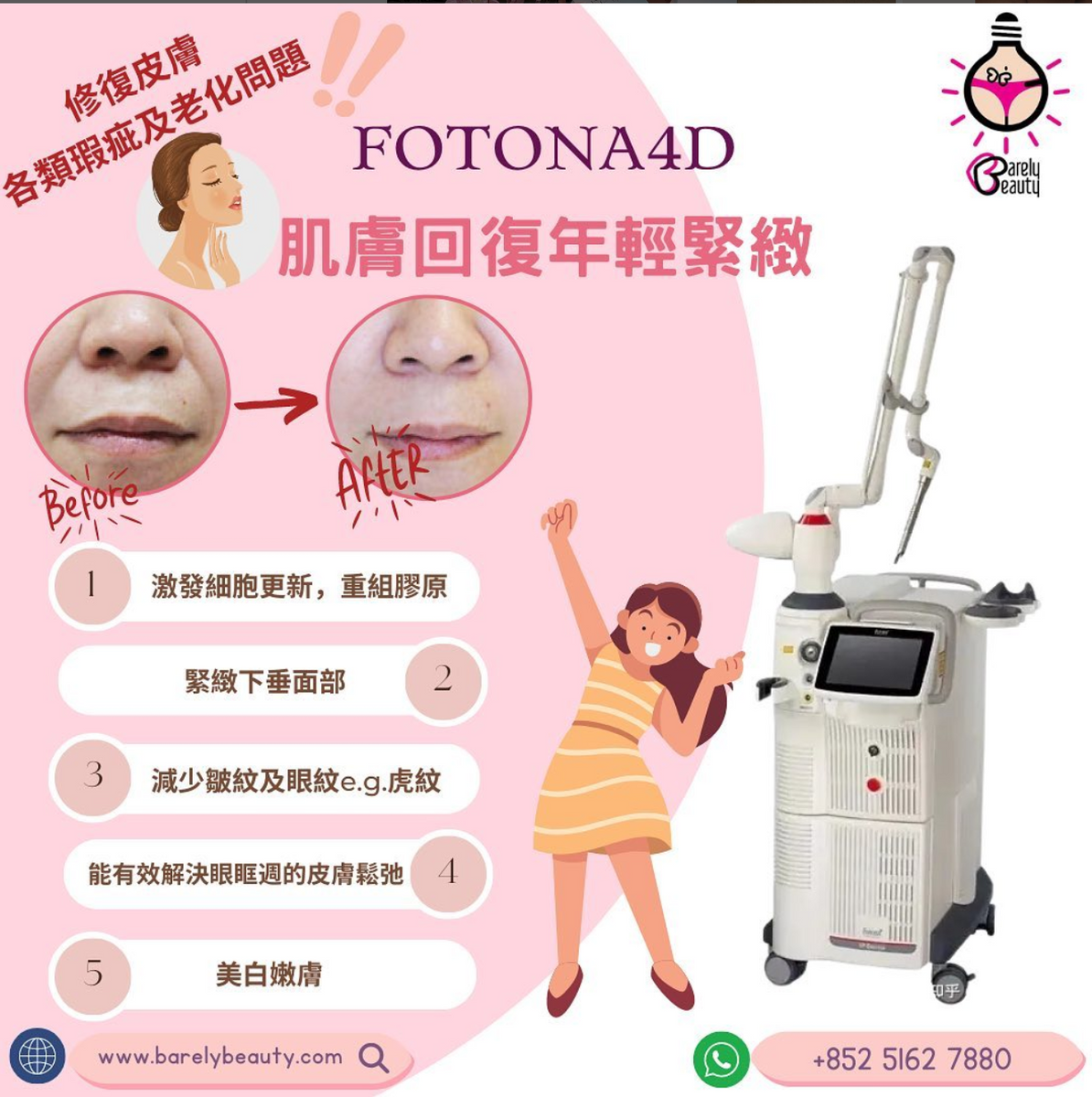 Fotona4D是一系列無創非侵入性激光療程 – Barely Beauty International Limited